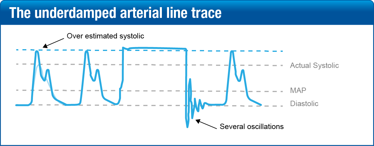 Pressure - Deltex Medical